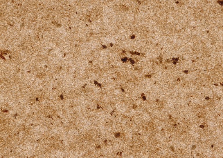 Some Of The Ways You Can Use Cork In Your Home - Architecture Exposed